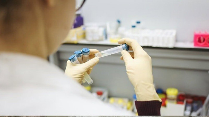 বিশ্বের প্রথম এইডস টিকা তৈরি করছে রাশিয়া - The Bangladesh Today